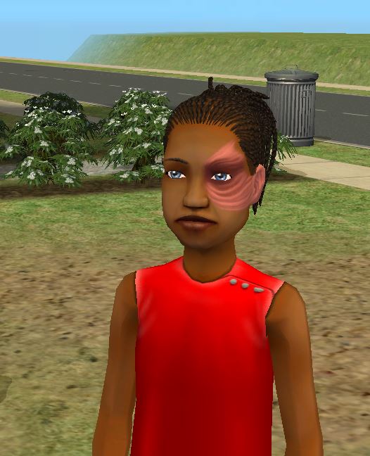 Mod The Sims - Zuko Burn Scar